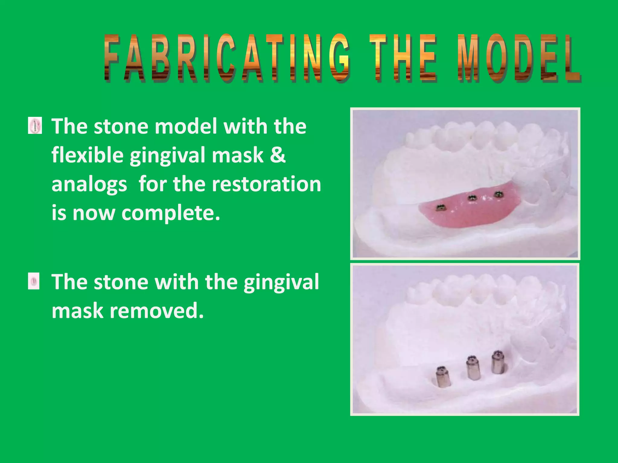 implant supported fixed restorations | PPTX