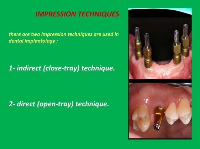 implant supported fixed restorations | PPTX | Dental Health | Diseases ...