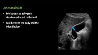 Gallbladder anatomy and the shape by Echo | PDF