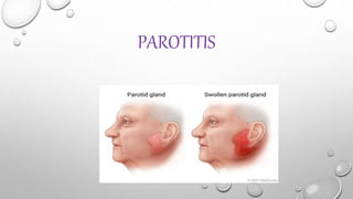 DISORDERS OF THE SALIVARY GLANDS.pptx