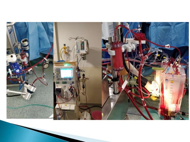 cytosorb therapy | PPTX | Heart and Cardiovascular Diseases | Diseases ...