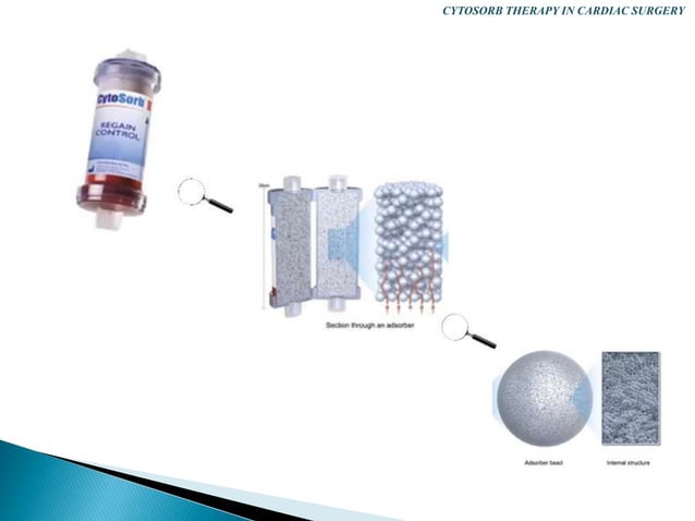 cytosorb therapy | PPTX | Heart and Cardiovascular Diseases | Diseases ...