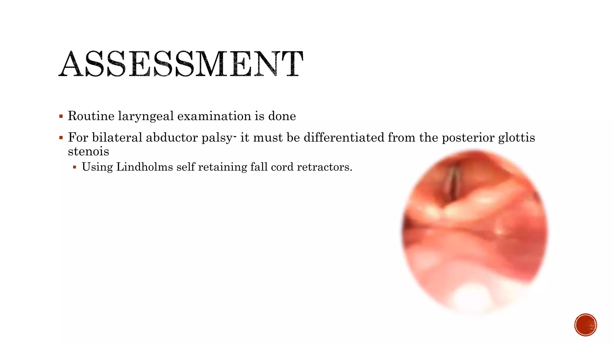 Vocal fold paralysis/ Paresis full | PPTX
