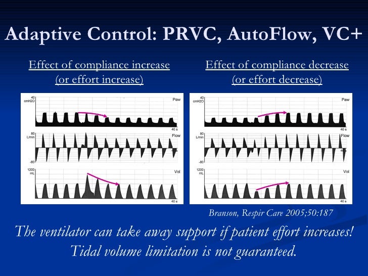 New Ventilator Modes: Do They Help?