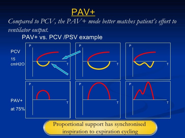 New modes of mechanical ventilation TRC