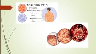 Pathophysiology on Monkeypox PPT .pptx