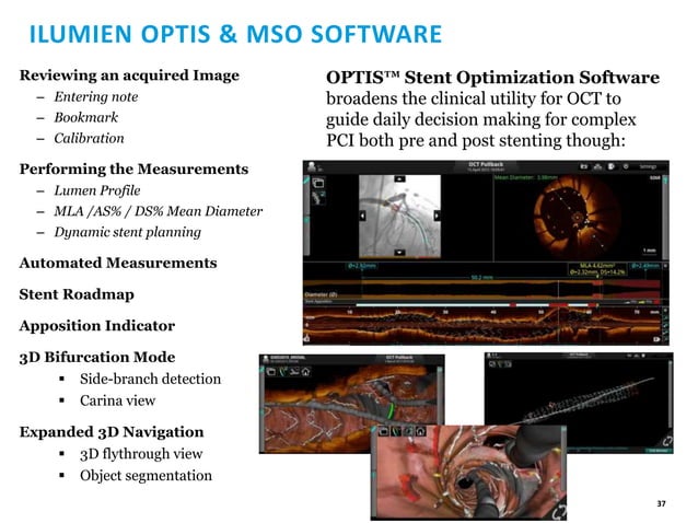 New OCT Slides for revascularisation and decision making | PPT