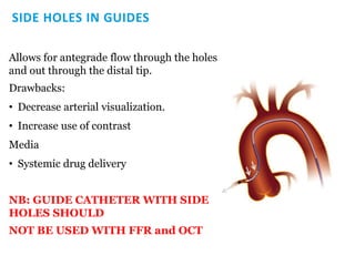 New OCT Slides for revascularisation and decision making | PPTX