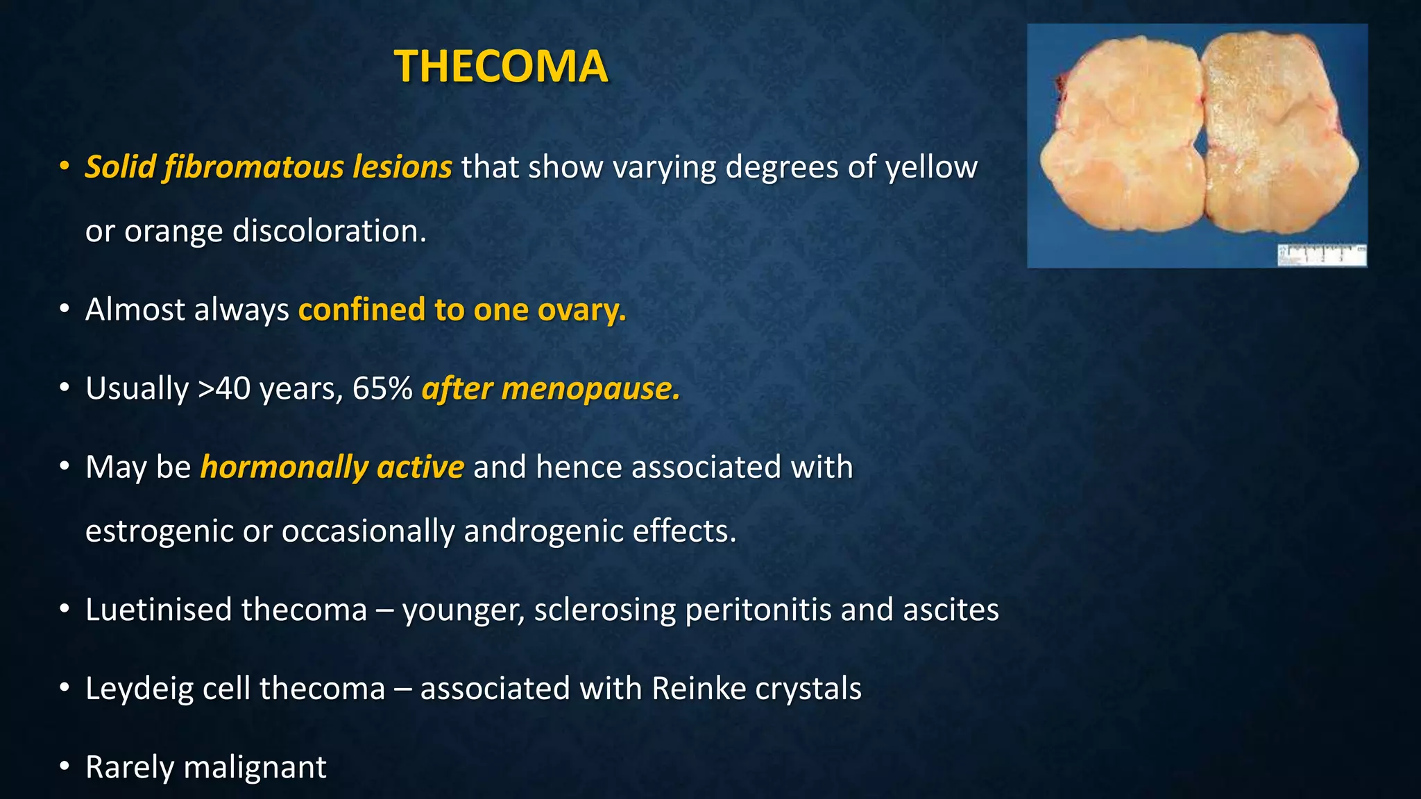OVARIAN TUMOURS | PPTX