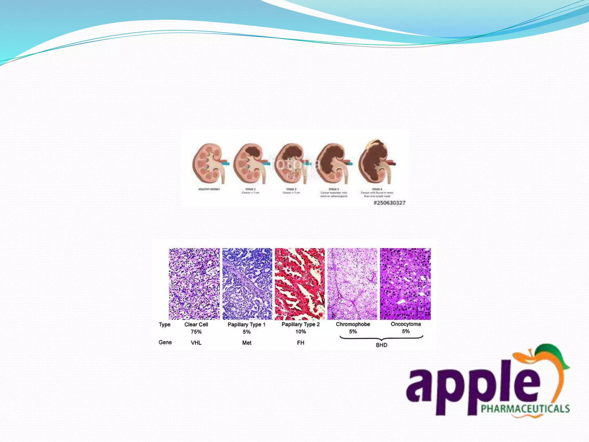 Votrient 200MG TABLET (Pazopanib Tablets) | Apple pharmaceuticals | PPTX