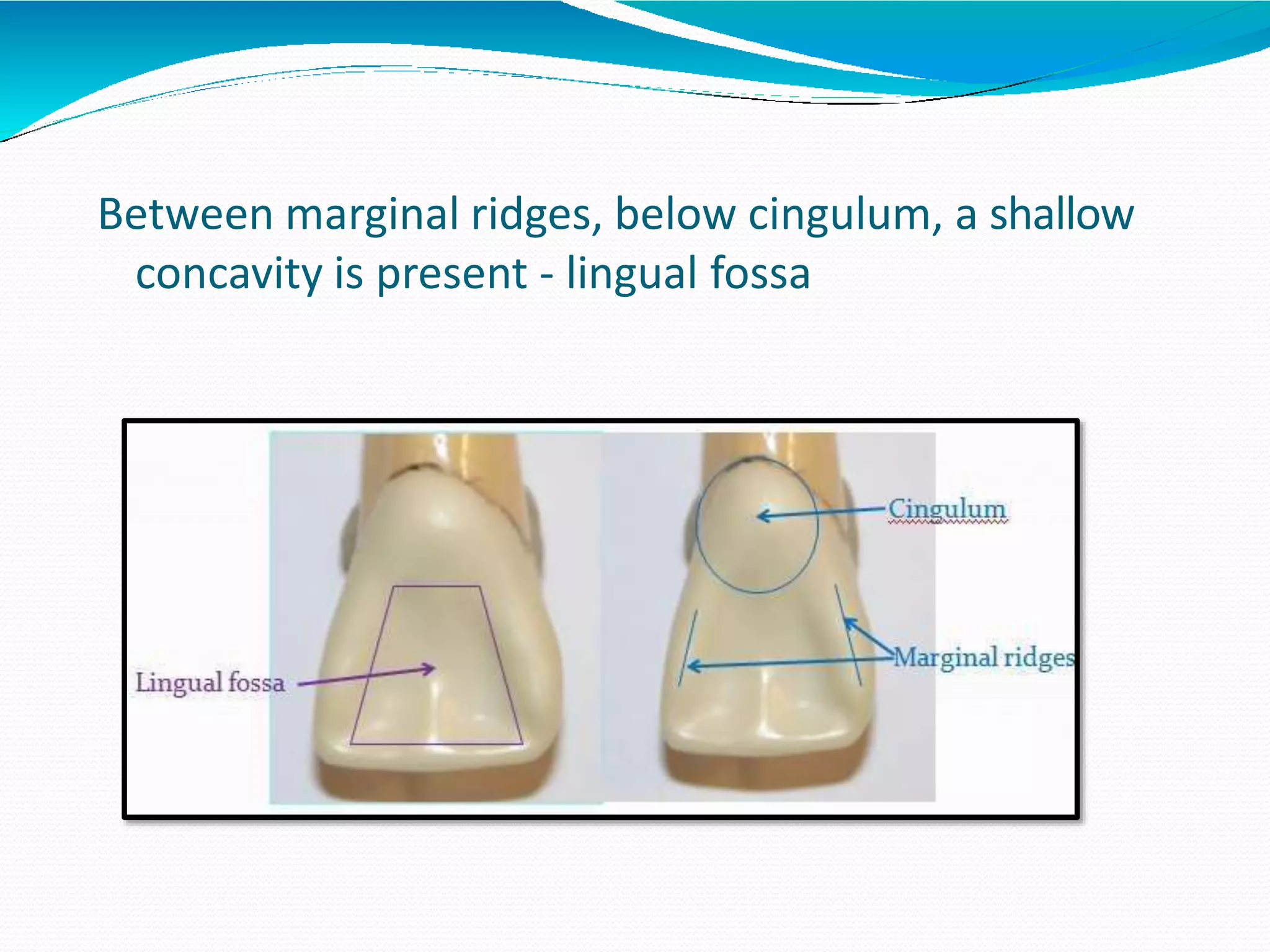 Maxillary Central Incisor | PPTX