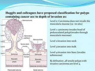 polyposis syndromes | PPTX