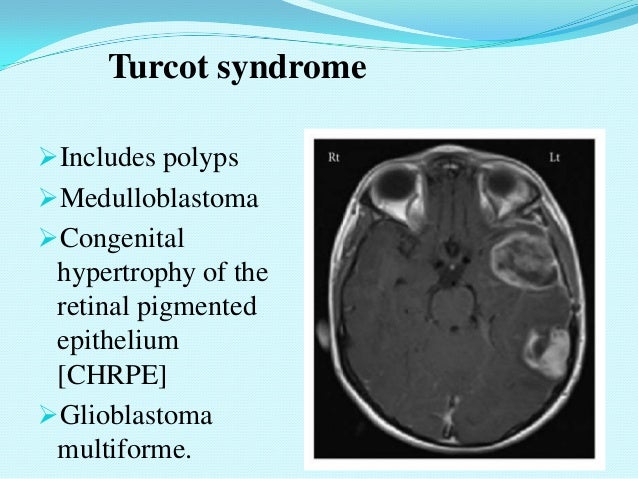 polyposis syndromes