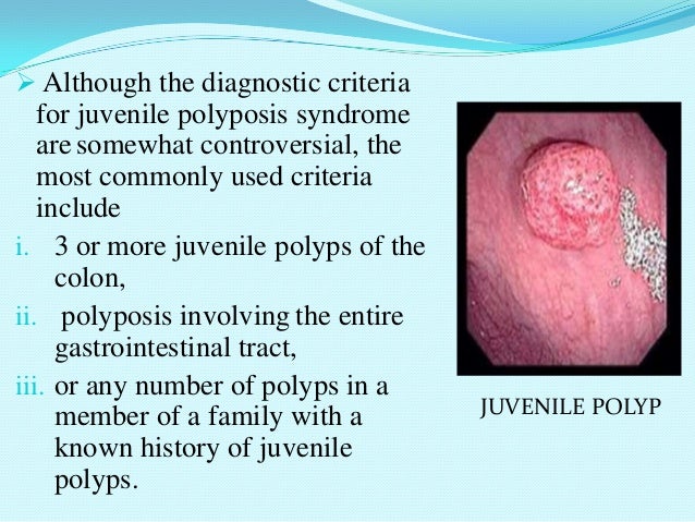polyposis syndromes