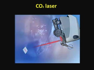 Vocal cord lesions and Phonomicrosurgery | PPTX