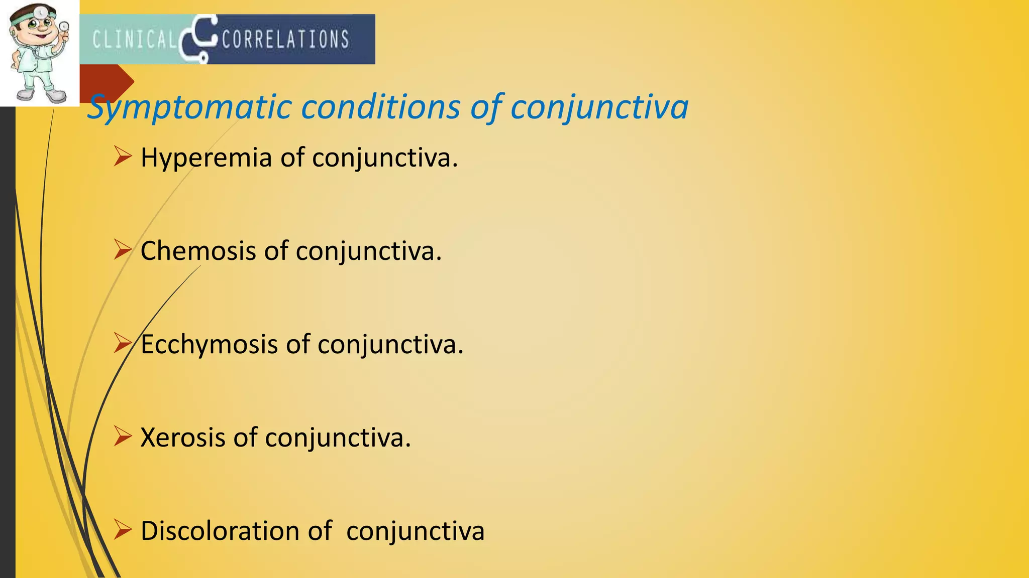 New real conjunctiva ,episclera ,sclera | PPTX