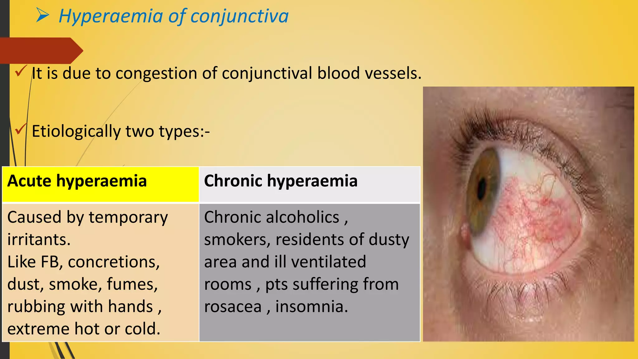 New real conjunctiva ,episclera ,sclera | PPTX