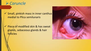 Plica Semilunaris Inflammation