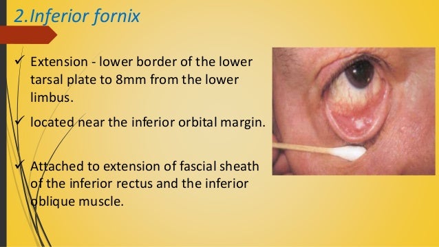 New real conjunctiva ,episclera ,sclera