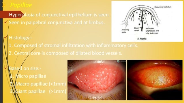 New real conjunctiva ,episclera ,sclera