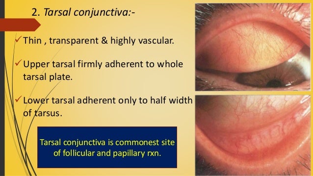 New real conjunctiva ,episclera ,sclera