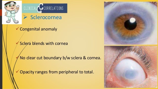 New real conjunctiva ,episclera ,sclera