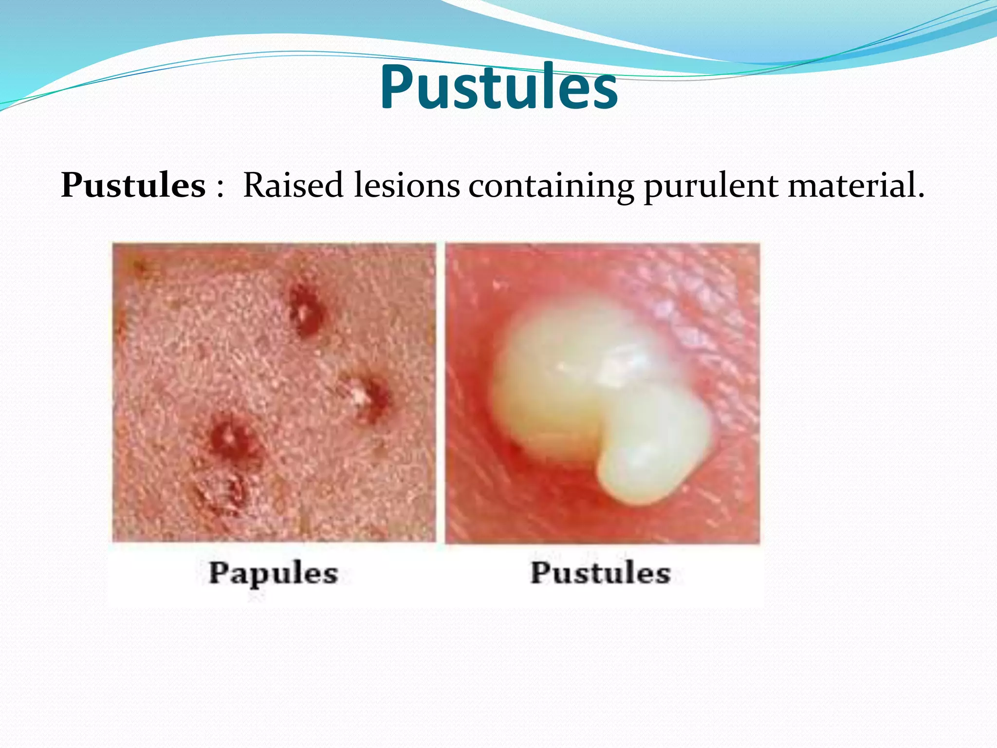 red & white lesions OMED 1 | PPTX