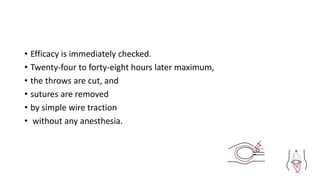 3 New removable uterine compression sutures | PPTX