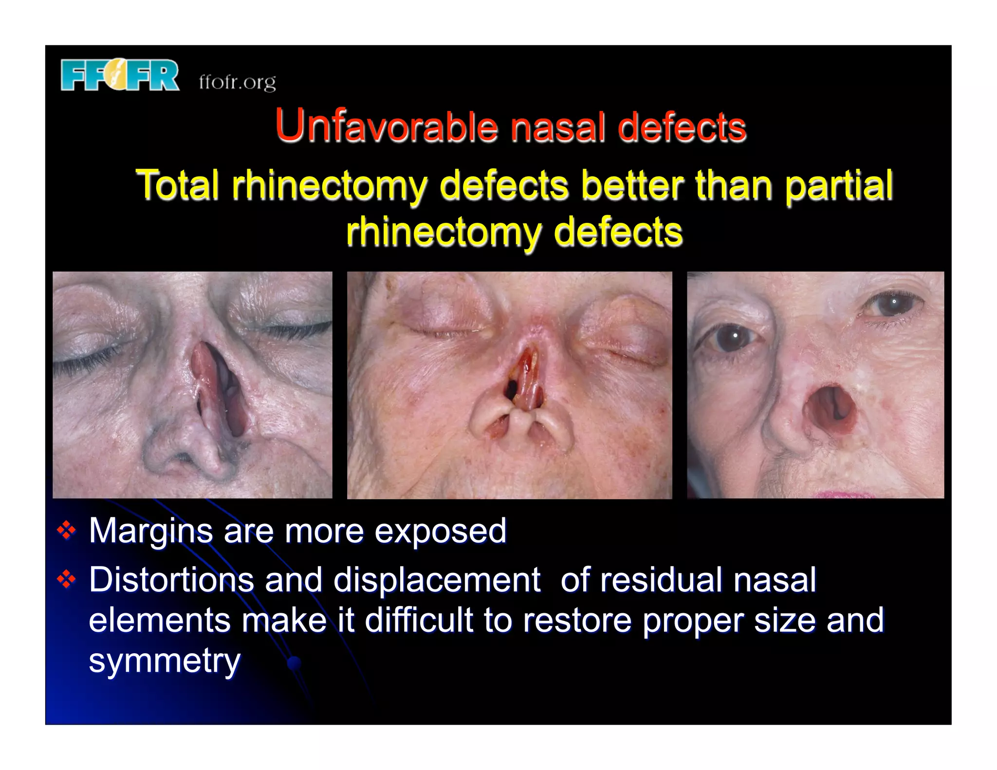 (New) restoration of facial defects basic priniciples | PDF