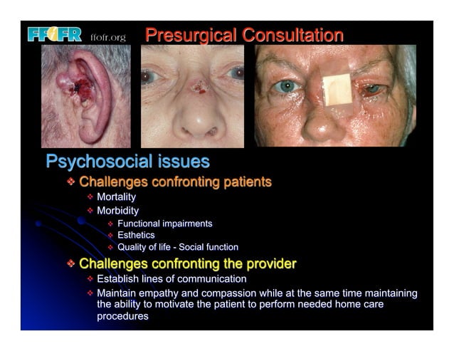 (New) restoration of facial defects basic priniciples | PPT