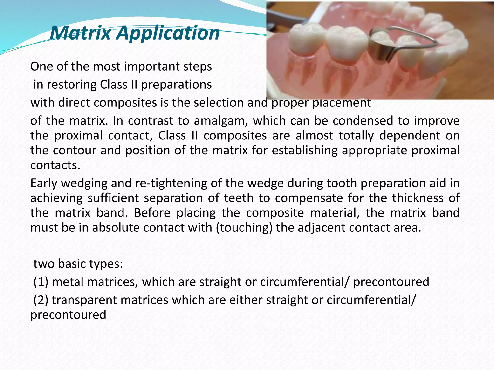 posterior direct composite restoration | PPTX