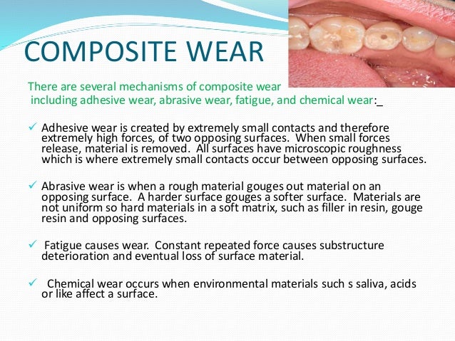 posterior direct composite restoration