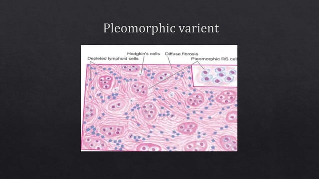 new seminar causes of splenomegaly .pptx | Free Download