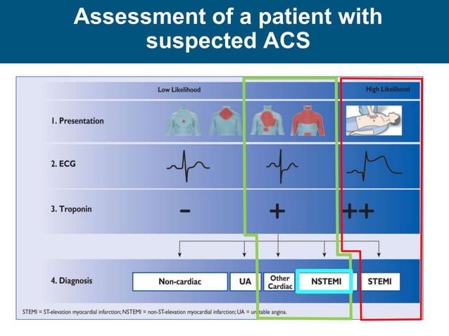 ECG interpretation: NSTEMI | PPT