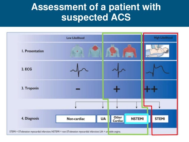 ECG interpretation: NSTEMI