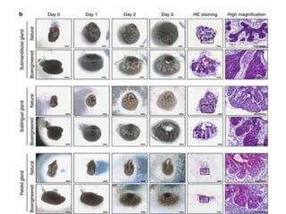 Stem cell therapy for xerostomia | PPTX | Ear, Nose and Throat ...