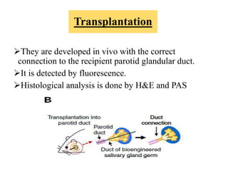 Stem cell therapy for xerostomia | PPTX | Ear, Nose and Throat ...