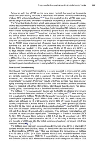 New strategies for endovascular recanalization of acute ischemic stroke. 2013 | PDF