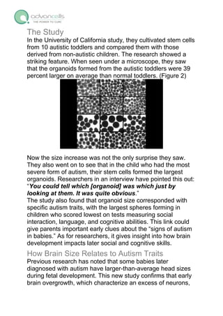 New Study Offers Insights Into Early Autism Detection In Babies | PDF