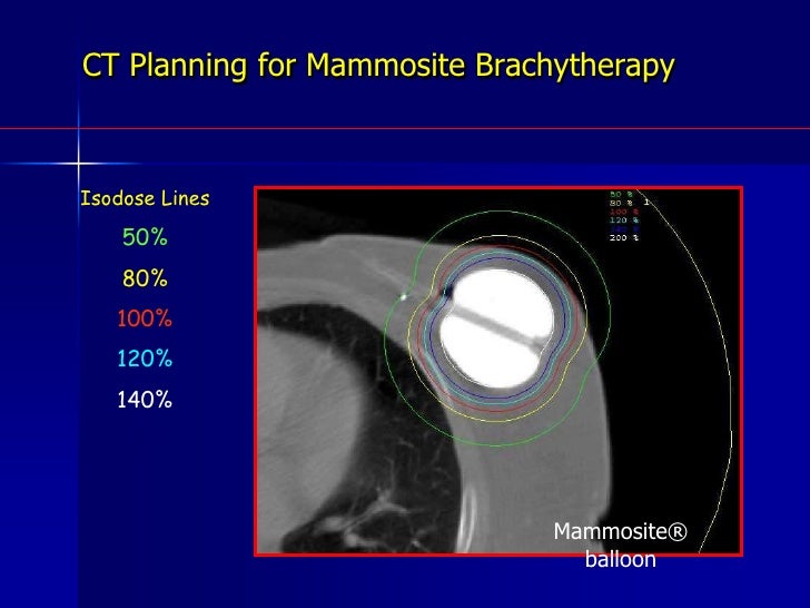 New techniques in breast radiotherapy
