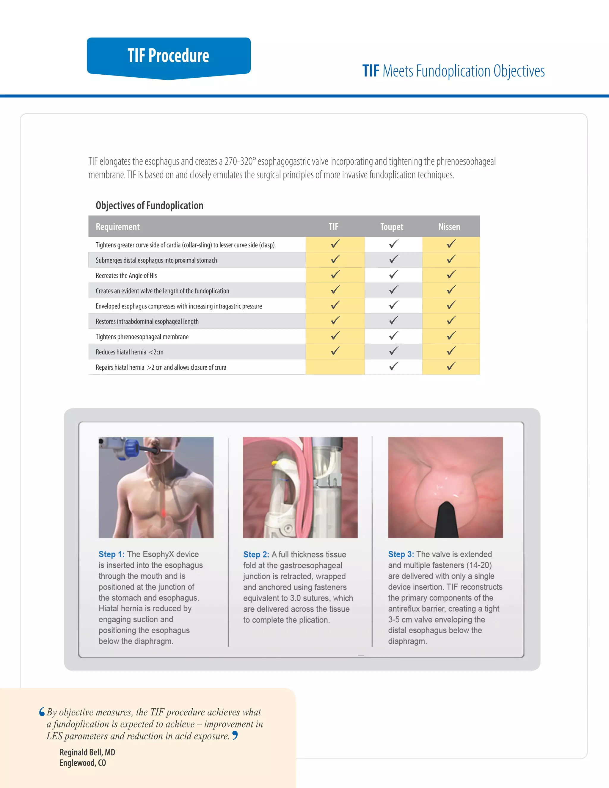 New Transoral Fundoplication Brochure | PDF