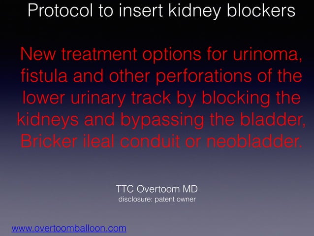 New treatment options for urinoma, fistula and perforations vers. 5.2 | PPT