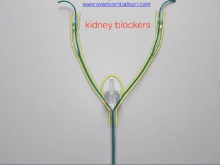 New treatment options for urinoma, fistula and perforations vers. 5.2 | PDF