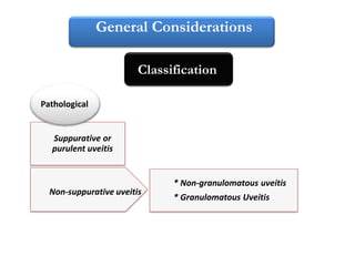 New trends in management of uveitis | PPTX