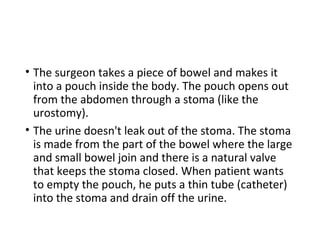 urinary diversions in bladder cancer | PPT
