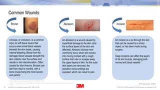 Nexcare tm wound care module 2020 | PPT