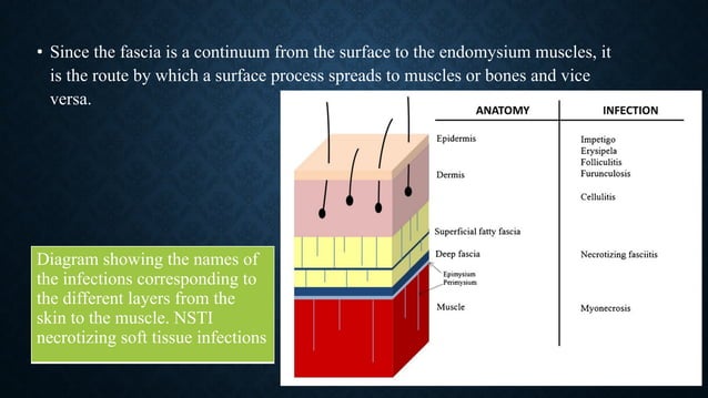 necrotizing soft tissue infection vs cellulitis | PPTX | Infectious ...