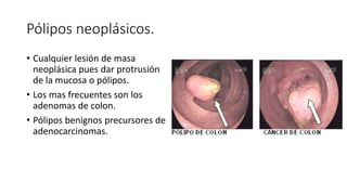 Anatomia patologica del colon | PPTX