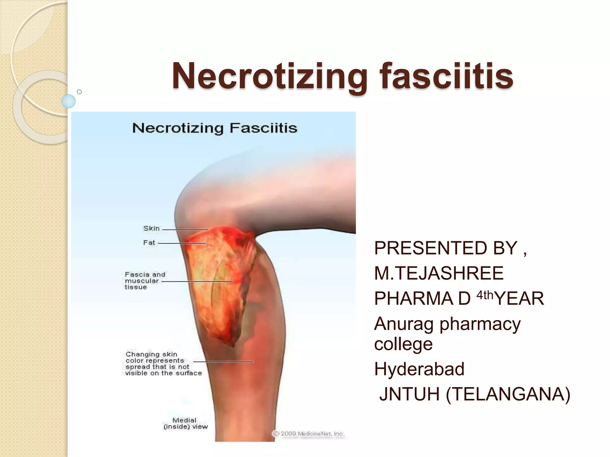 Necrotizing fasciitis Case presentation | PPT