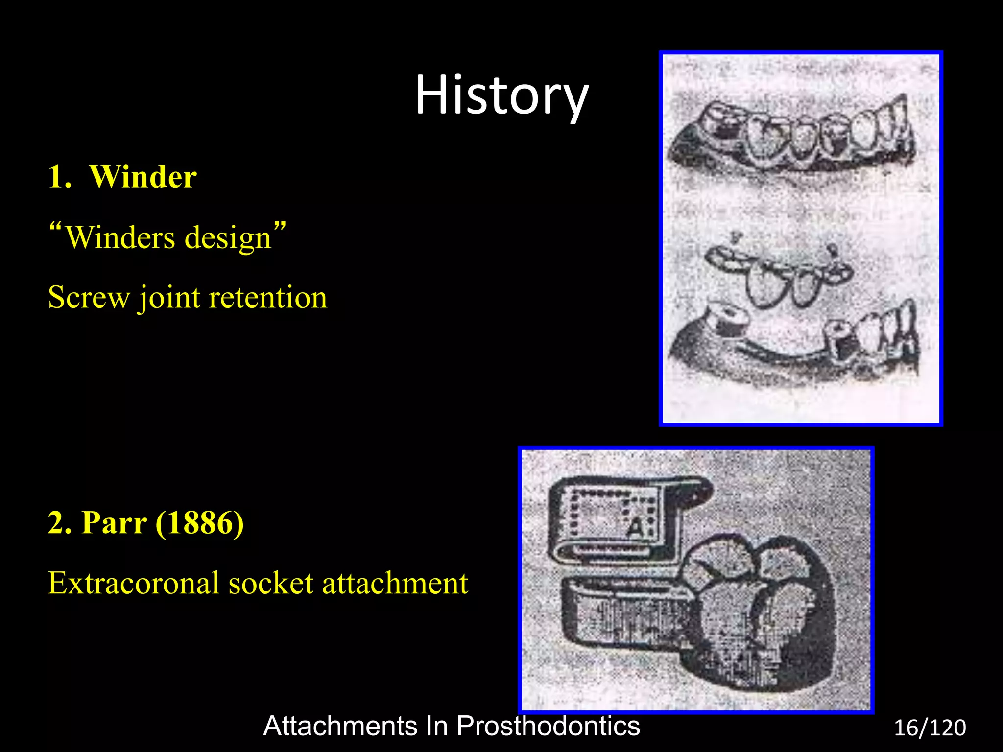 Attachments In Prosthodontics | PPTX